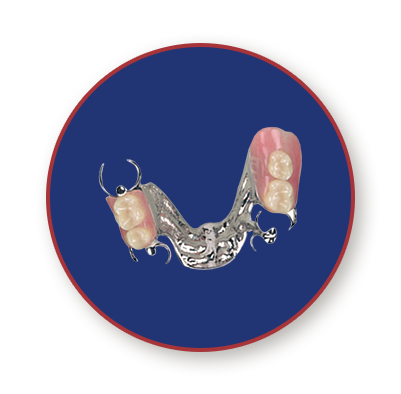 Partials – Jet Stream Dental Laboratory